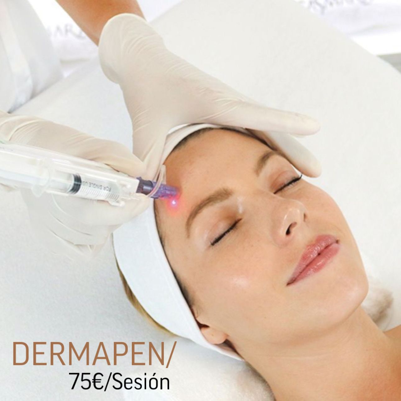 Nuevo servicio de Dermapen - Centro Estético Elena Sotillo